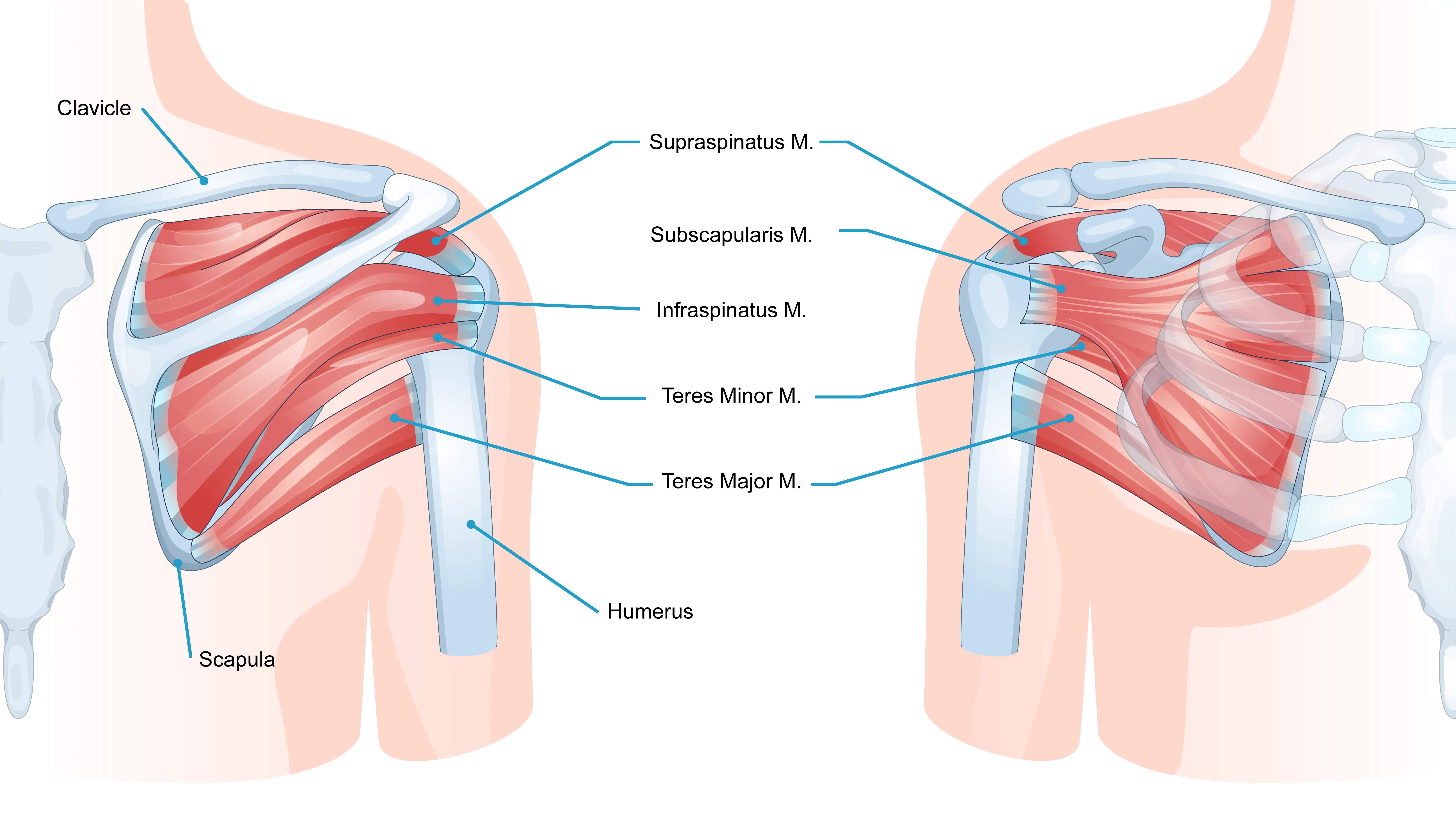 Pros and Cons of Reverse Shoulder Replacement Surgery